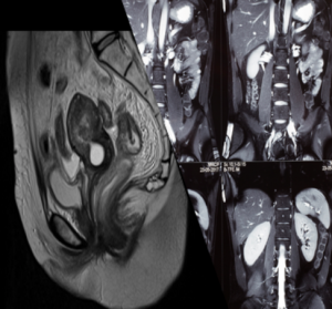 Magnetna rezonancija abdomena i karlice - Euromedik