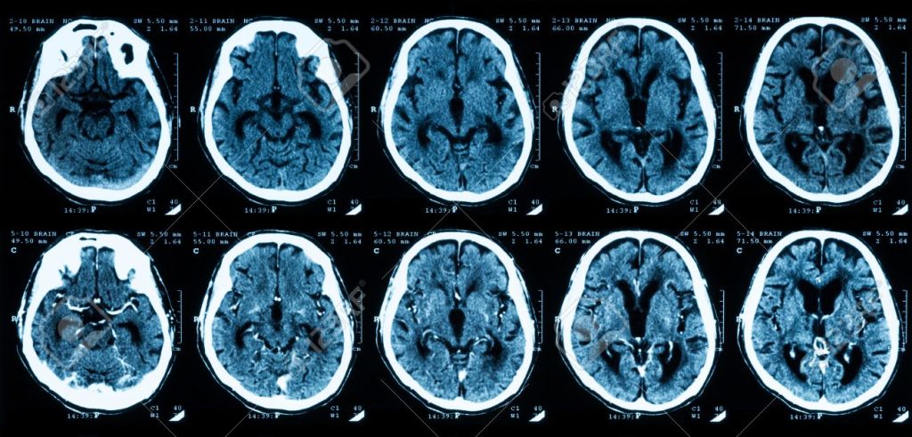Skener glave CT - Dijagnostika i lečenje Euromedik