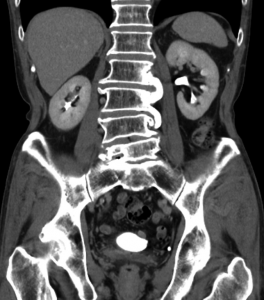CT urografija pregled - Dijagnostika i lečenje Euromedik