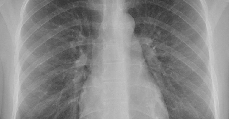 Rendgen (RTG) - Euromedik